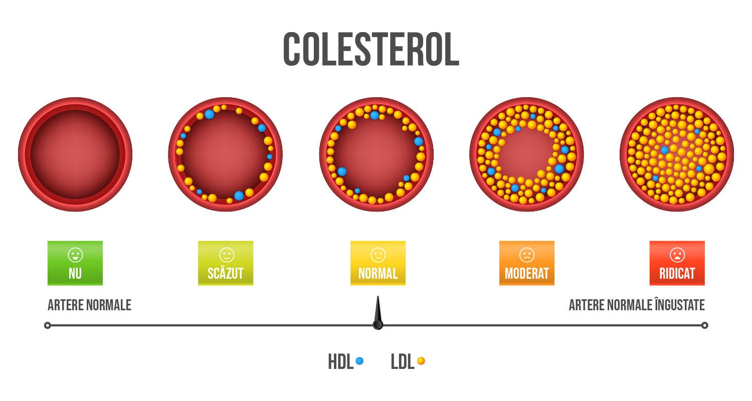 Despre colesterolul ”bun” și cel ”rău” – DEFIRO